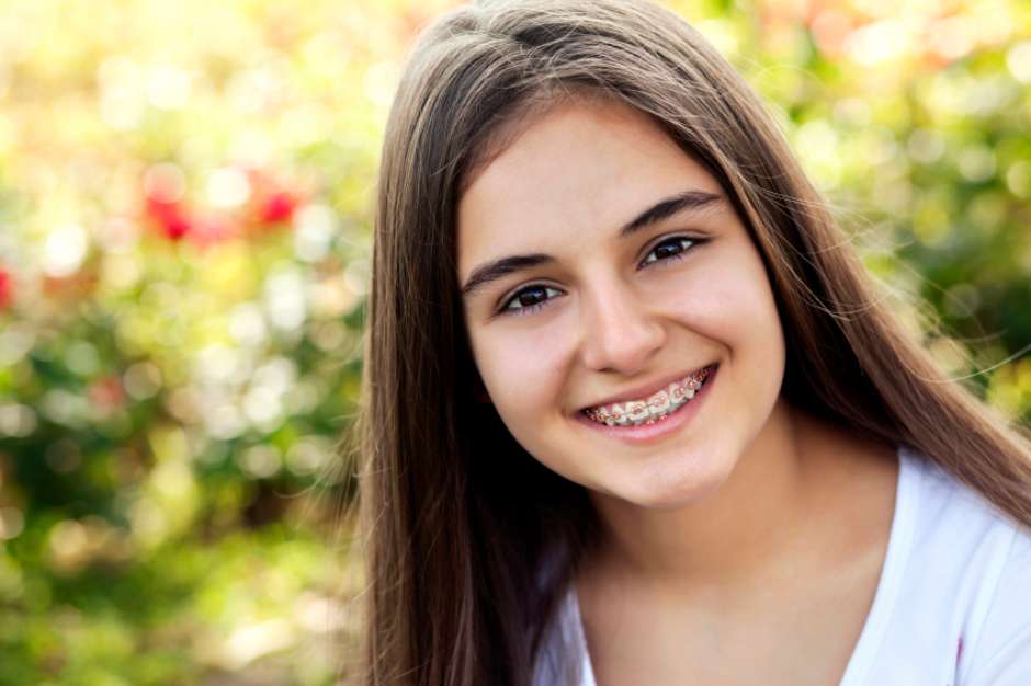 Mantener tus brackets - Clínica dental Alicia Felici